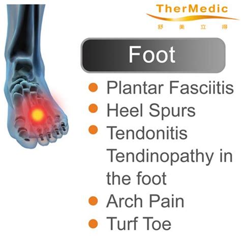 Does Heat Help Plantar Fasciitis At Sandra Galvez Blog
