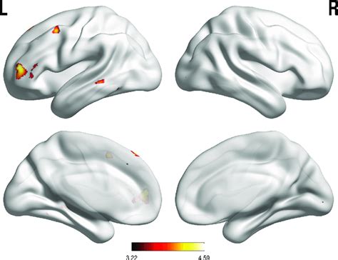 Whole Brain Correlation Analysis For Na Reactivity During Uninstructed Download Scientific
