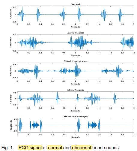 Brief Review — Heart Sound Multiclass Analysis Based On Raw Data And Convolutional Neural