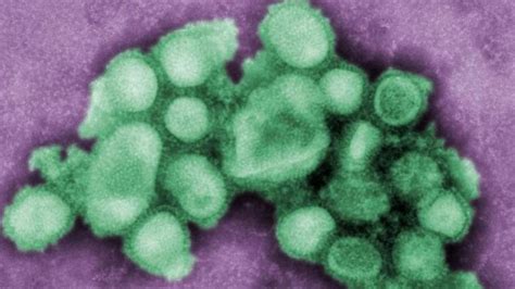 What Is The New G4 Virus Why Does It Have Pandemic Potential As Some