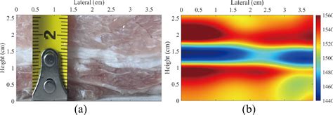 Figure 1 From Ultrasound Speed Of Sound Reconstruction Based On Local