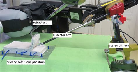 Ontology Based Surgical Subtask Automation Automating Blunt Dissection
