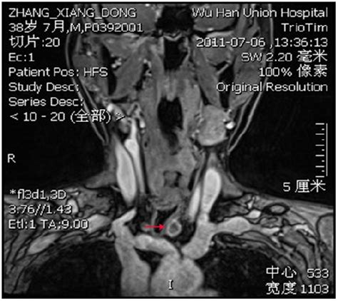 A 39 Year Old Man Presented With A Suspicious Lymph Nodes In Central Download Scientific