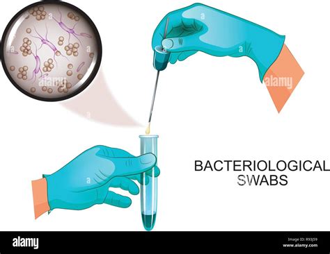 Bacteriological Culture Test At Eugene Bergeron Blog