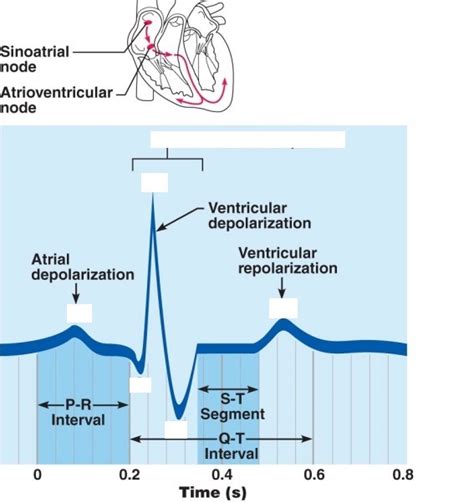 Atrial Depolarization On Ekg