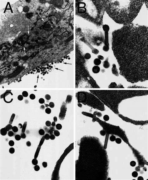 evaluation of recombinant rv expressing hiv 1 gag by electron