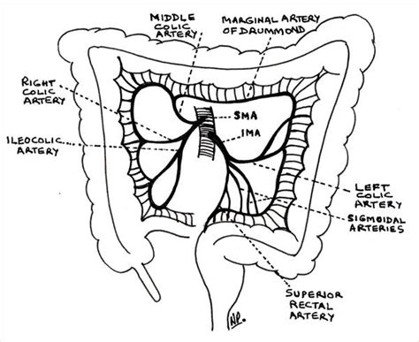 Em Didactic The Deadly Mesenteric Ischemia Time Is Bowel