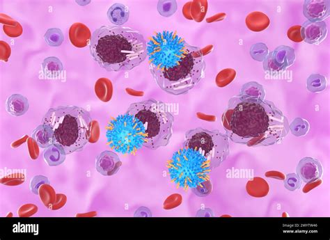 Car T Cell Therapy In Chronic Lymphocytic Leukemia Cll Isometric