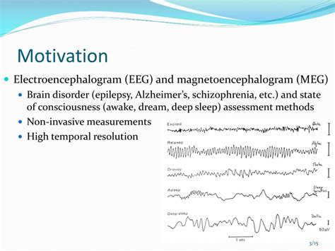 PPT Feature Extraction From Electroencephalographic Records Using EEGFrame Framework