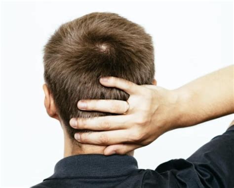 Possible Tmj Dislocation I Have Picture For Reference And Screenshot Of The Story R Tmj