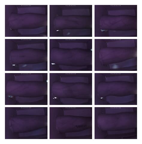 Image Samples From The Collected Dataset Download Scientific Diagram