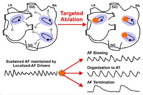 Defining Atrial Fibrillation Af Drivers Af Drivers Are Defined As Download Scientific