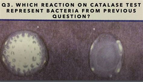 Solved Q3 Which Reaction On Catalase Test Represent