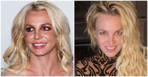 What Is Happening To Britney Spears Teeth
