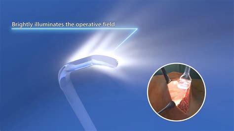 Disposable Lighted Retractor Shelly Lighting