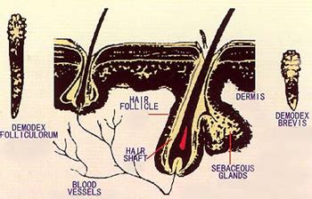 Parasitophilia Demodex Folliculorum