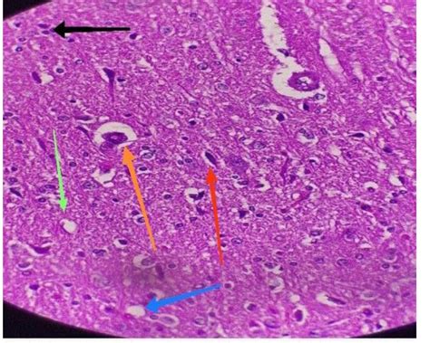 A Cross Section In The Brian Of A Fetus Rat From The Group Treated With Download Scientific
