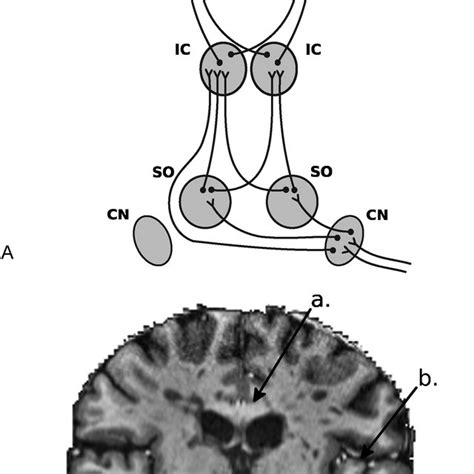 Left A Schematic Diagram Of The Principal Ascending Central Auditory