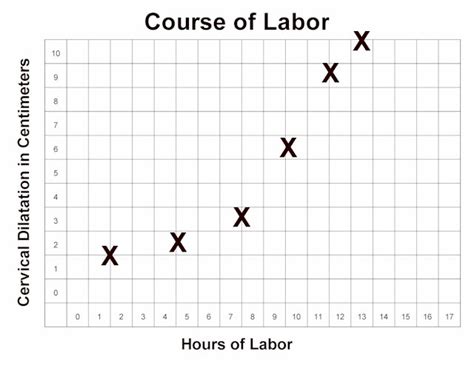 labor