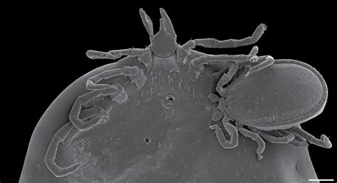 Tick Bites Tick Tiny Male Puts The Bite On An Engorged Female Live Science