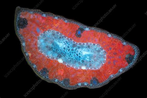 Scots Pine Pinus Sylvestris Leaf Light Micrograph Stock Image C057 6655 Science Photo