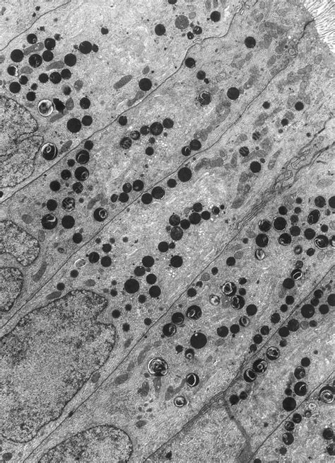 Lysosome Micrograph Tem Of Primary Lysosome In Liver Cell Stock