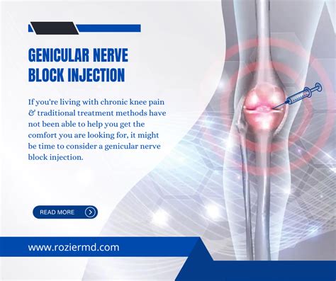 Genicular Nerve Block Cpt