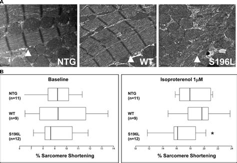 Ultrastructural Analysis And Contractile Function In Ntg Wt And S196l