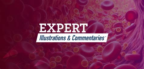 The Consequences Of Doxycycline Postexposure Prophylaxis Contagion Live