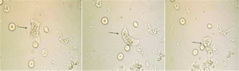 Lecture Notes In Medical Technology The Free Living Amoeba