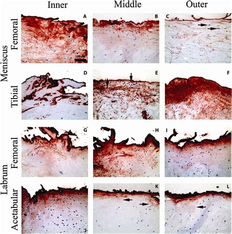 Micrographs Showing Representative Positive Immunohistochemical