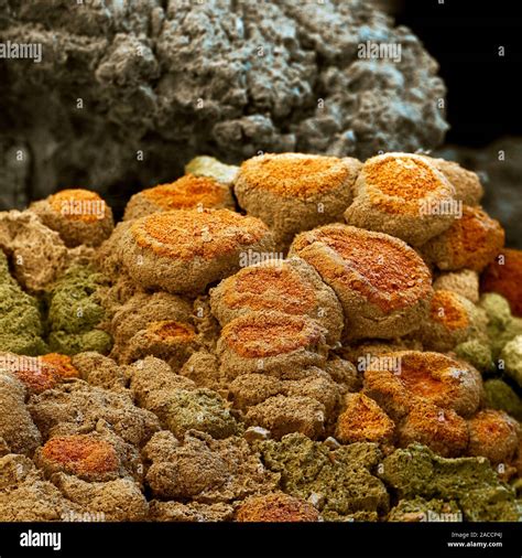 Lichen Coloured Scanning Electron Micrograph Sem Of Lichen