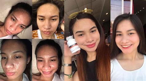 Babae Inanitan Ng Mukha - mukha sumikat