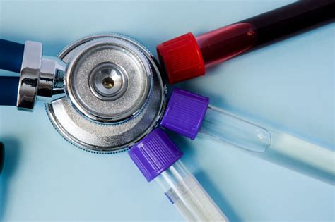 다이어 프 램과 청진 기 Chestpiece 및 혈액과 다른 체액 3 실험실 테스트 튜브 닫습니다 흰색 배경에서 근접 촬영 간 내부 기관에 대한 스톡 사진 및 기타 이미지