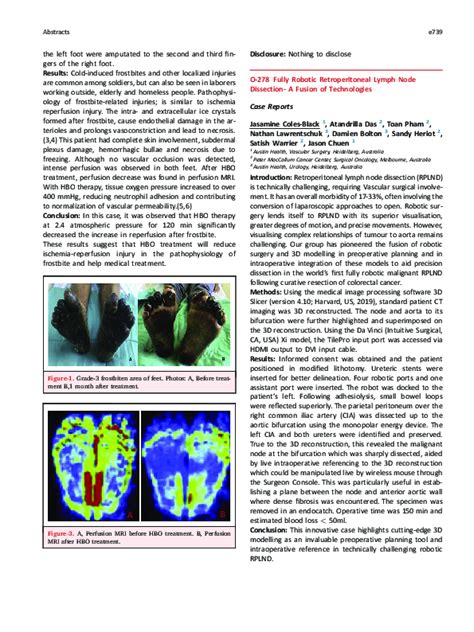 Pdf Fully Robotic Retroperitoneal Lymph Node Dissection A Fusion Of Technologies