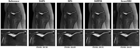 Improving Diffusion Inverse Problem Solving With Decoupled Noise Annealing
