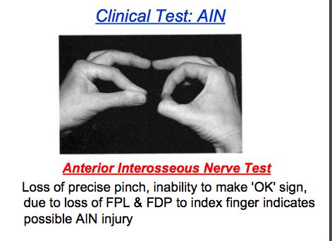 Anterior Interosseous Syndrome Ok Sign
