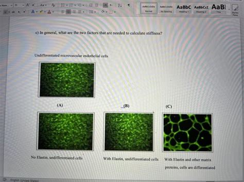 Solved Iii Undifferentiated Microvascular Endothelial Cells