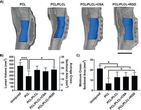 Microcomputed Tomography μct Reconstruction And Analysis Using Avizo