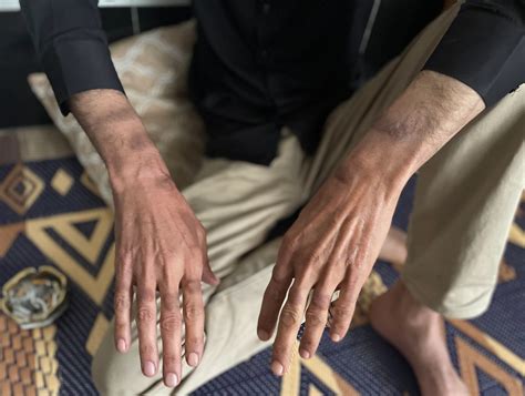 Us Abuse And Horrid Photo In Abu Ghraib Left His Life Still Ruined