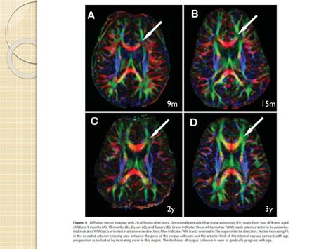 Ppt Myelination In Pediatric Neurology Powerpoint Presentation Free Download Id 2298467