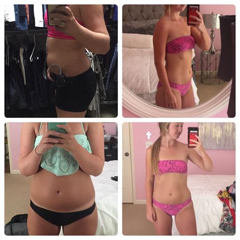 201 Best R Hypothyroidism Images On Pholder Pops Pill