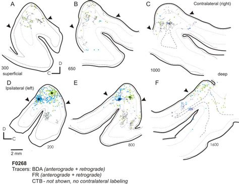 Labeling In The Contralateral Auditory Cortex Following Injections Into Download Scientific