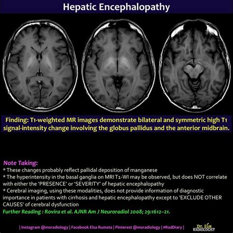 Pin Di Upgrading To Mri