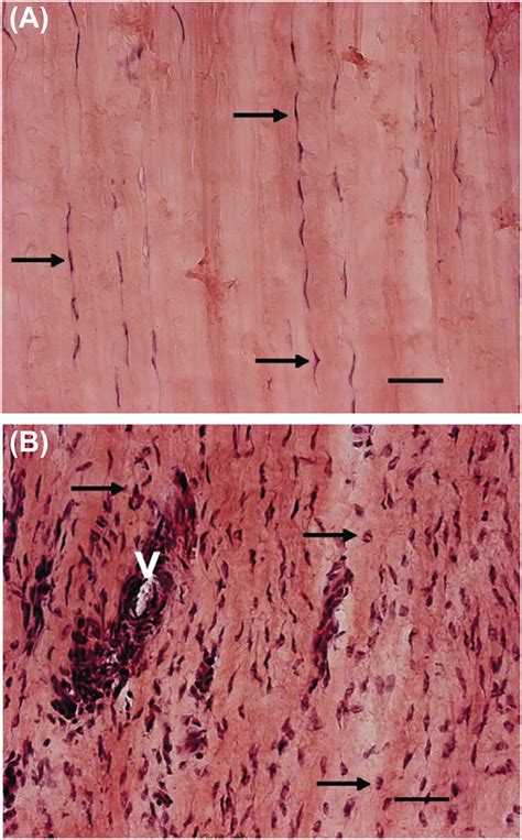 Microscopic Anatomy A B Micrographs Of Tendon Biopsies From A