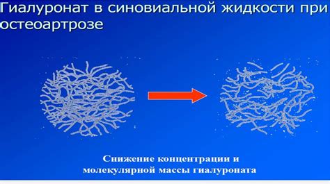 Применение препаратов гиалуроновой кислоты в комплексном лечении