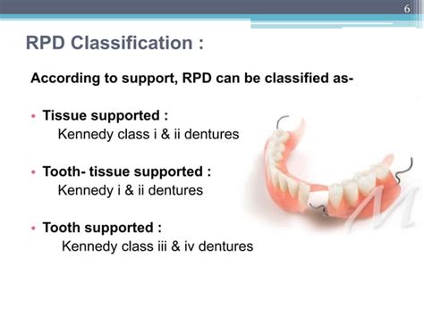 Principles Of Rpd Design According To Kennedy Classification Pptx