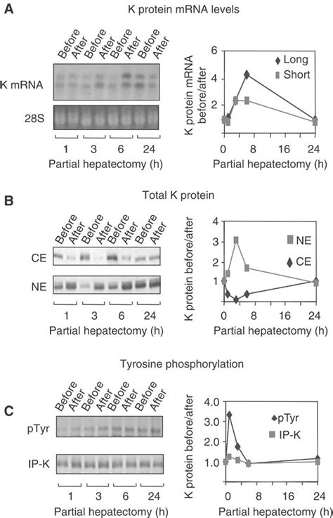 K Protein Expression After Partial Hepatectomy In Mice A Total Rna Download Scientific