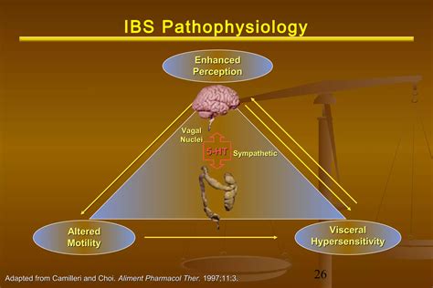 Ibs Presentation Ppt