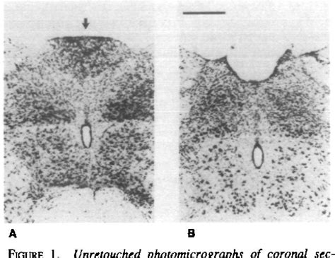 Figure 1 From Area Postrema Is Critical For Angiotensin Induced